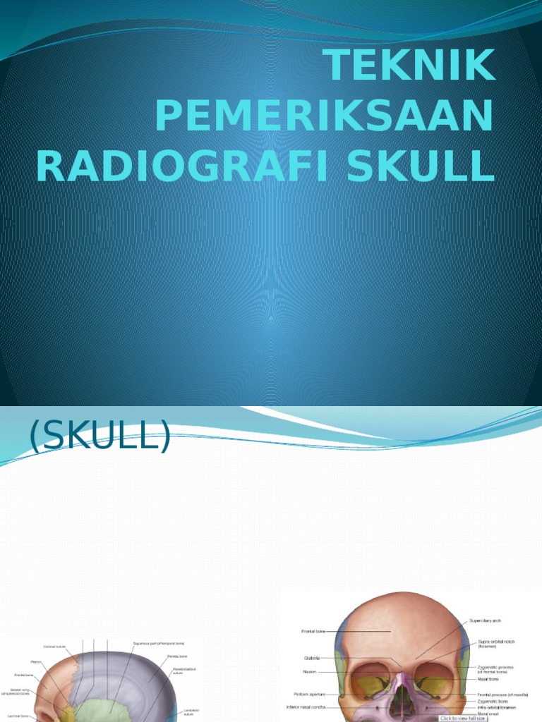 Teknik Pemeriksaan Radiografi Skull | PDF
