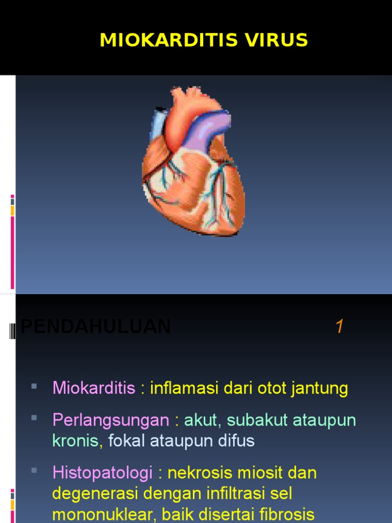 Miokarditis | PDF