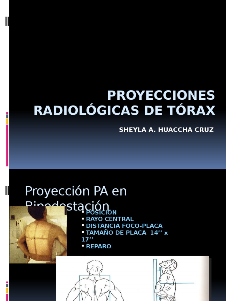 Proyecciones Radiologicas de Torax | PDF