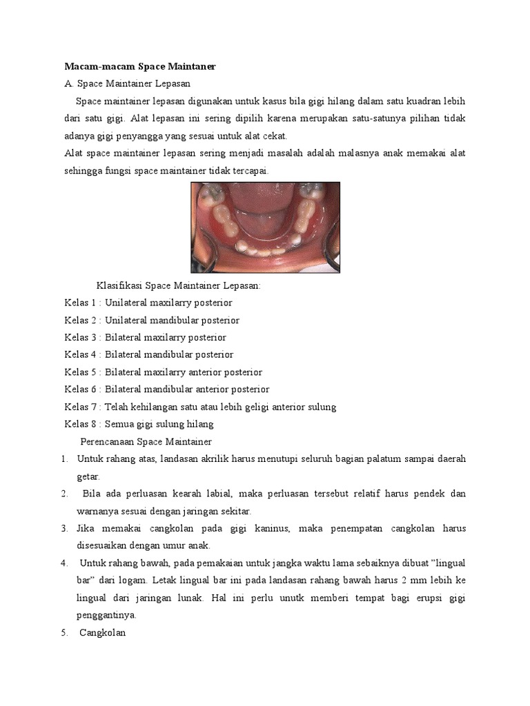 Macam Space Maintainer | PDF
