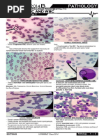 ACR BI-RADS® Atlas Fifth Edition | PDF | Mammography | Clinical Medicine