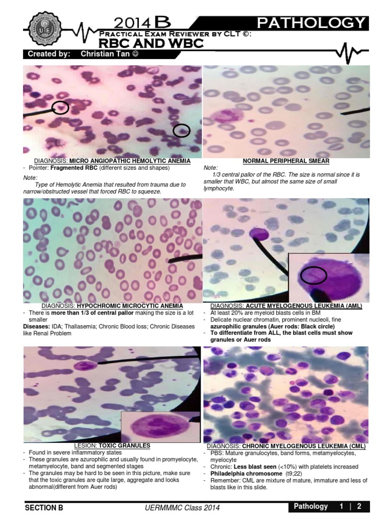 PATHO Practicals - RBC and WBC Pathology (CLT) | PDF | White Blood Cell ...