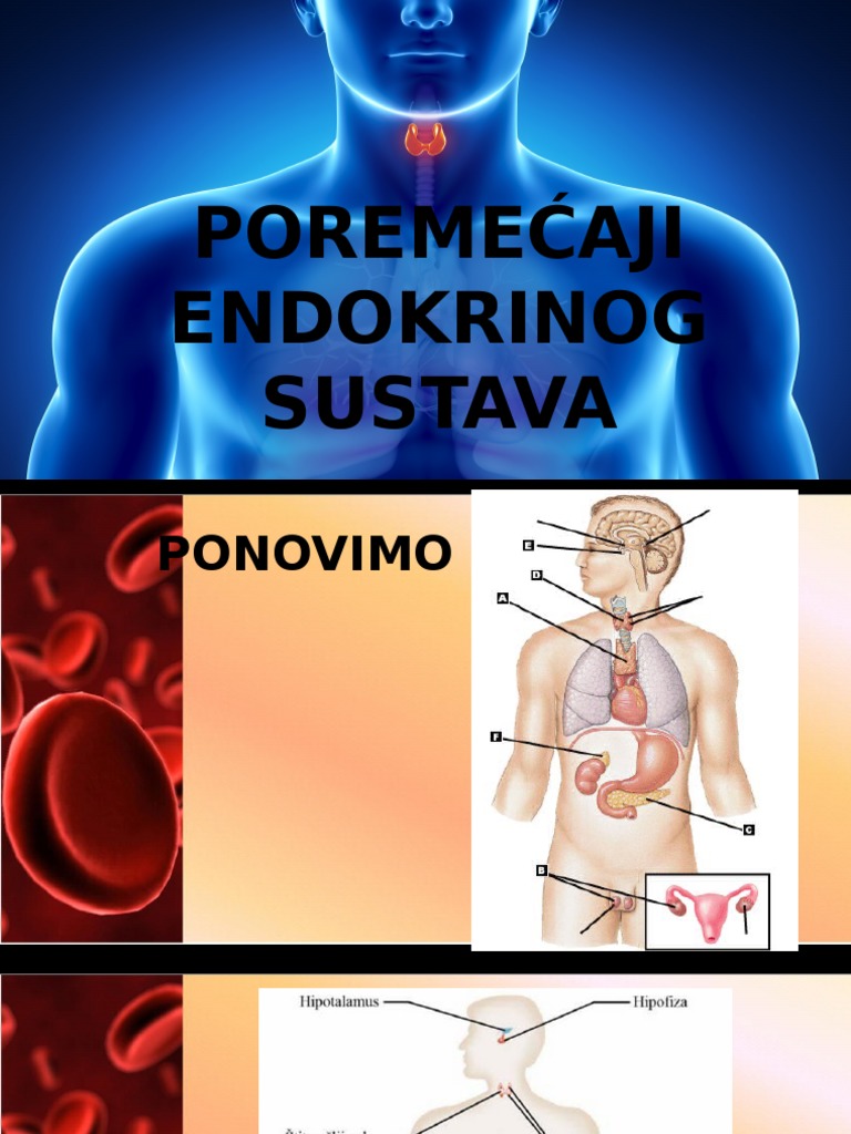 Biologija - Poremećaji Endokrinog Sustava | PDF