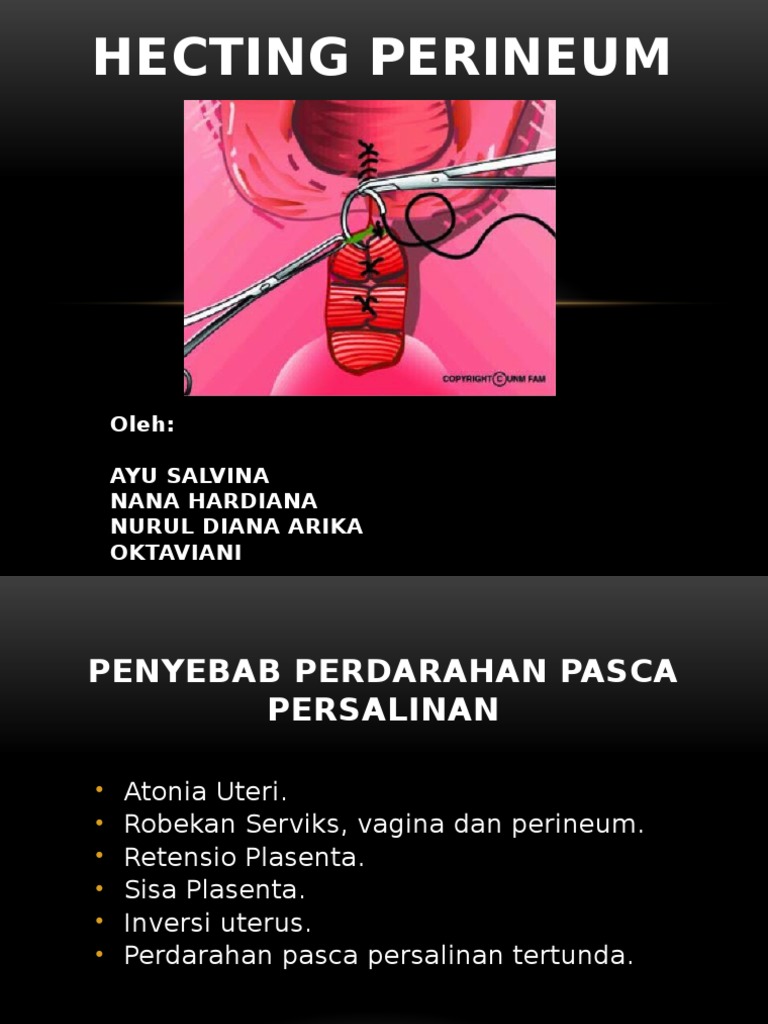 Hecting Perineum | PDF