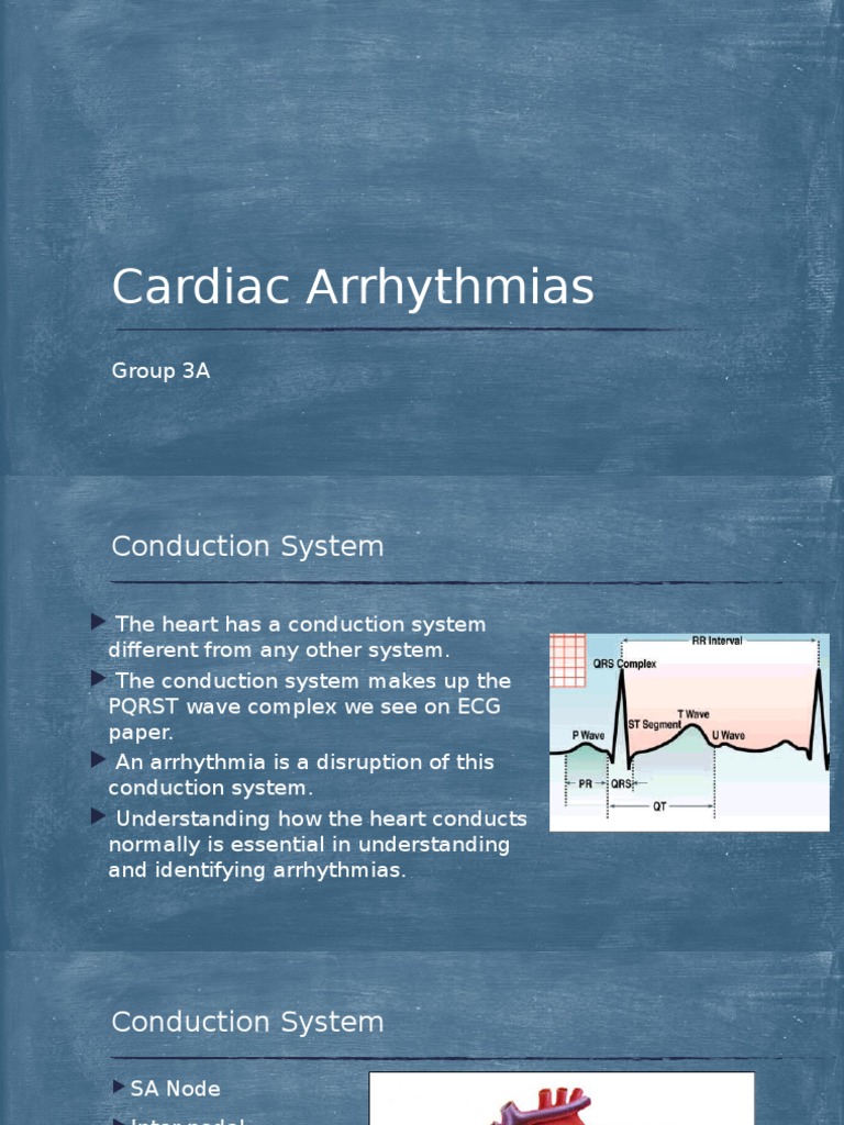 Cardiac Arrhythmias: Group 3A | PDF | Electrophysiology ...