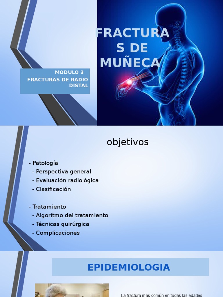 FX Radio Distal | PDF | Trastornos musculoesqueléticos | Sistema ...