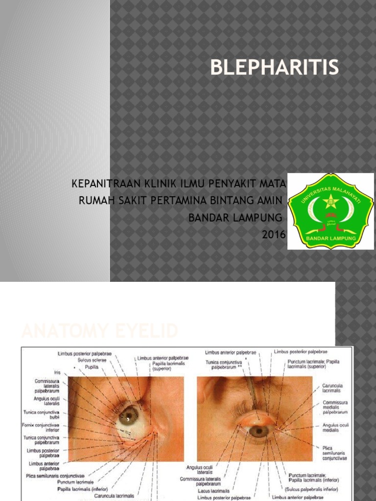 BLEPHARITIS | PDF | Diseases And Disorders | Immunology