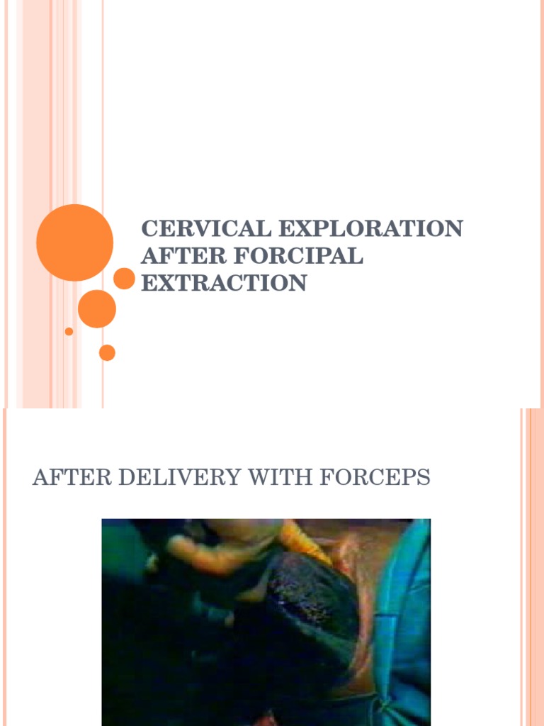 How To Explore After Forceps Extraction | PDF