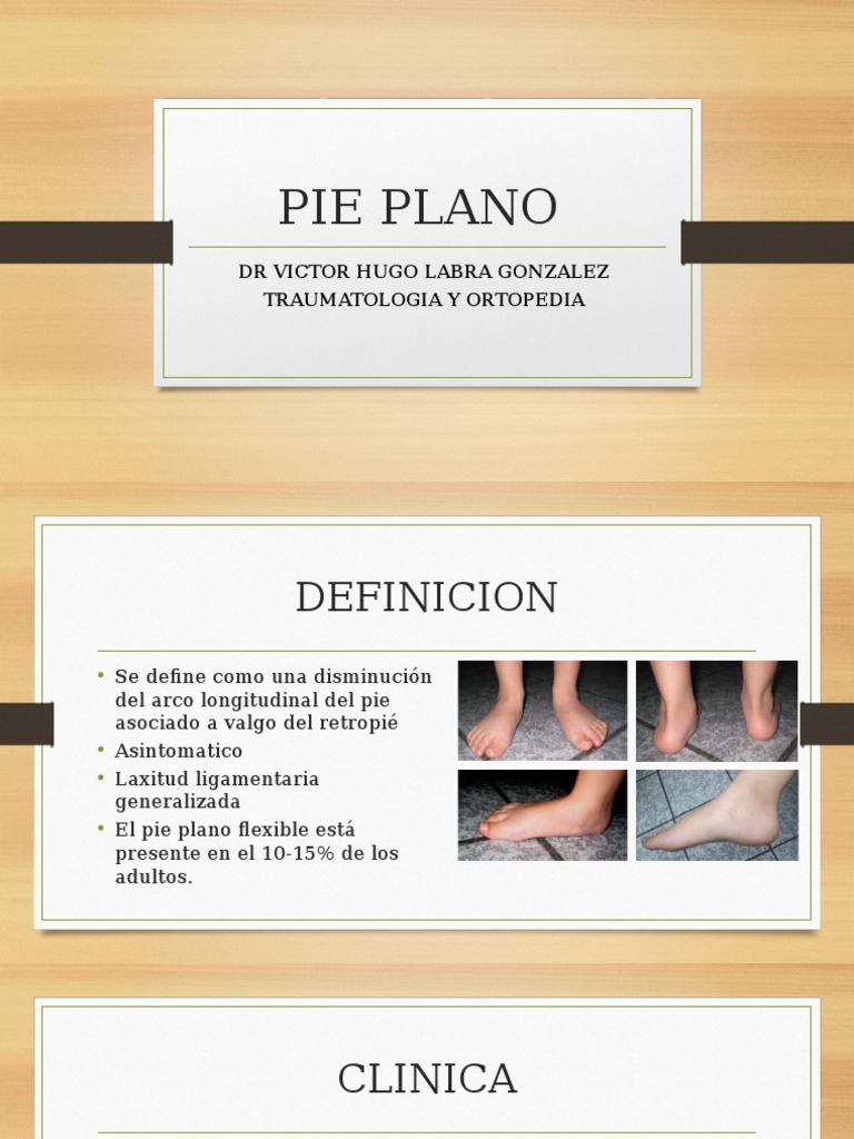 Pie Plano | PDF | Pie | Tobillo