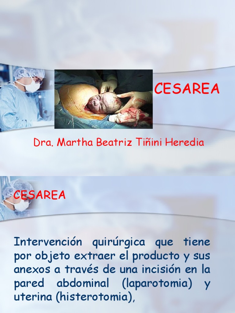 Cesarea | PDF | Seccion de cesárea | Parto