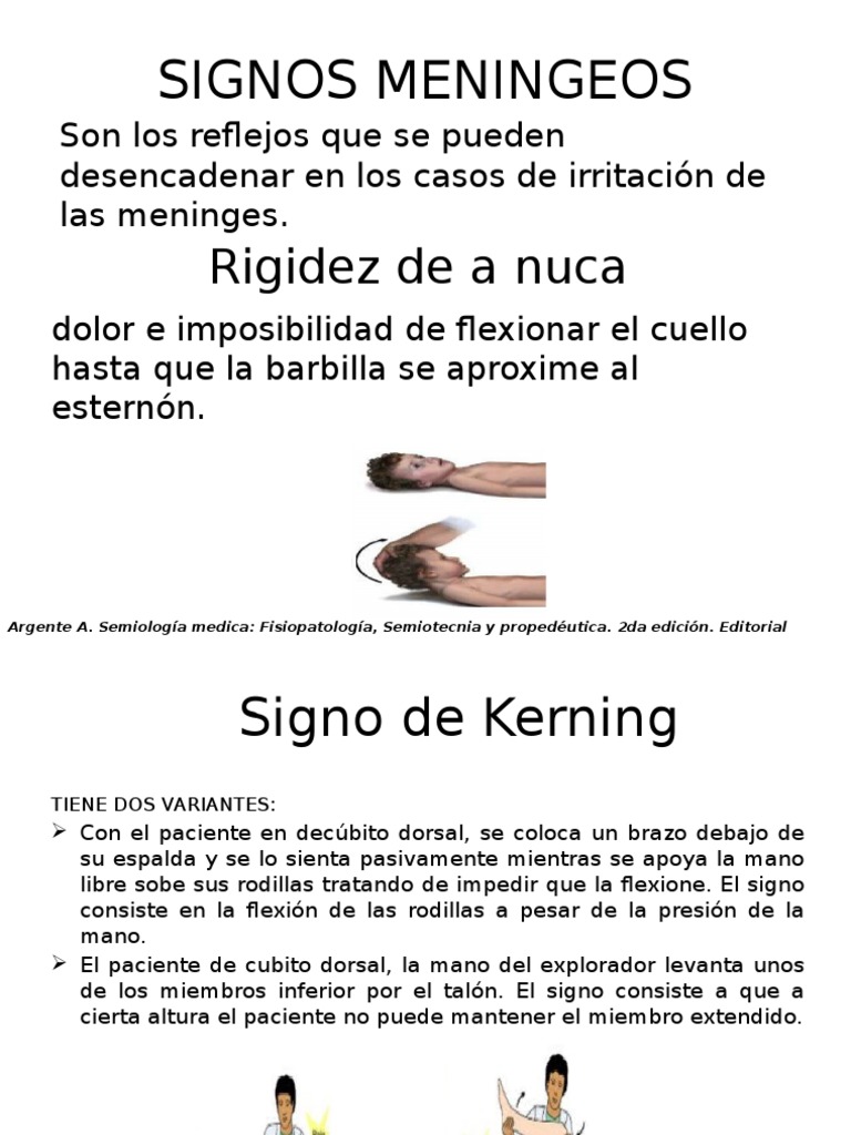 SIGNOS MENINGEOS