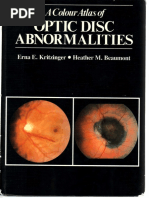 Papilledema Grading System (Frisen Scale) | PDF