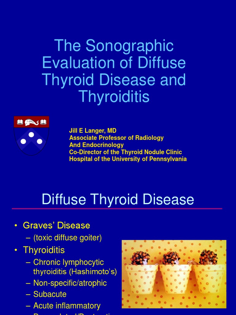 Diffuse Thyroid Disease Presentation Toronto | PDF | Thyroid ...