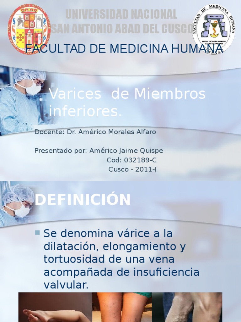 Varices De Miembros Inferiores Pdf Venas Varicosas Sistema