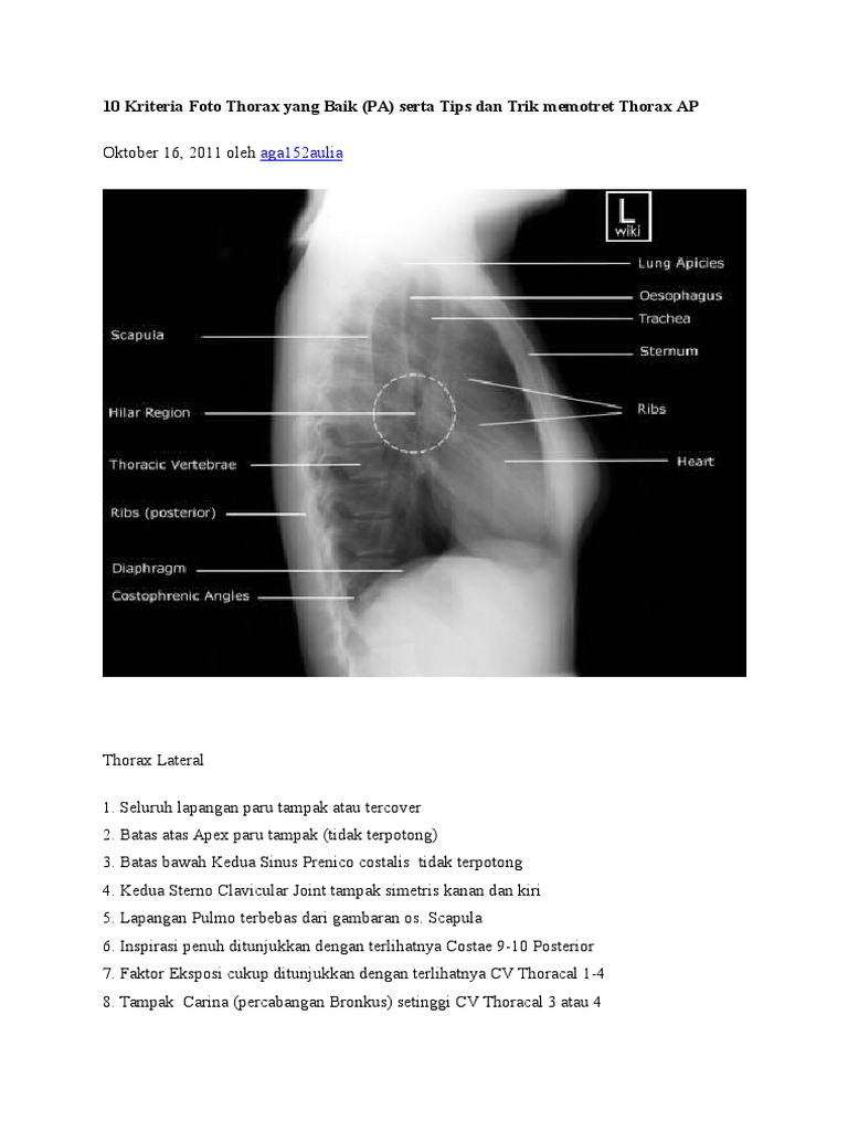 10 Kriteria Foto Thorax Yang Baik | PDF