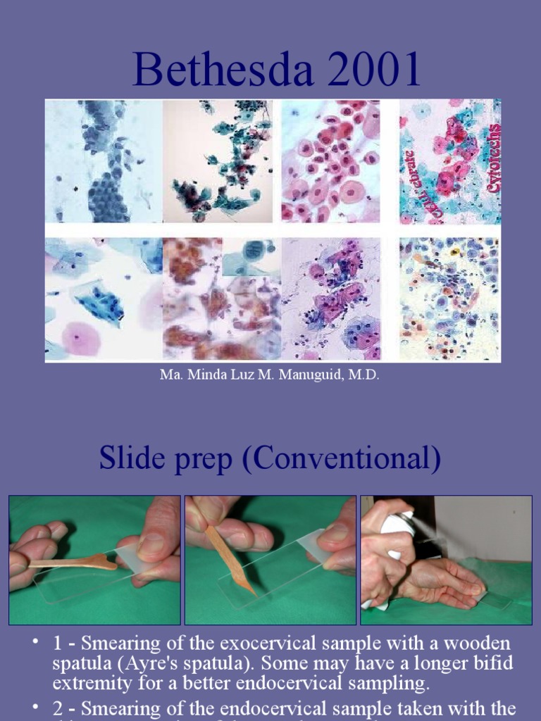 Bethesda 2001 | PDF | Microscopy | Carcinoma