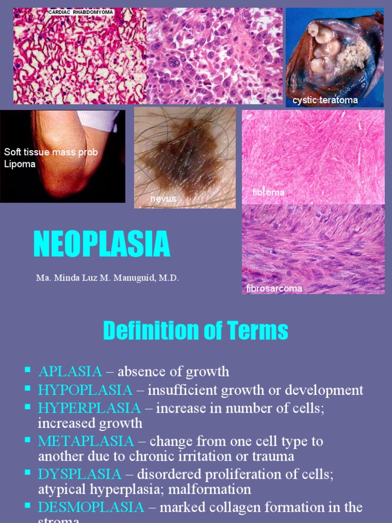 Genpath Neoplasia | PDF | Neoplasms | Cancer