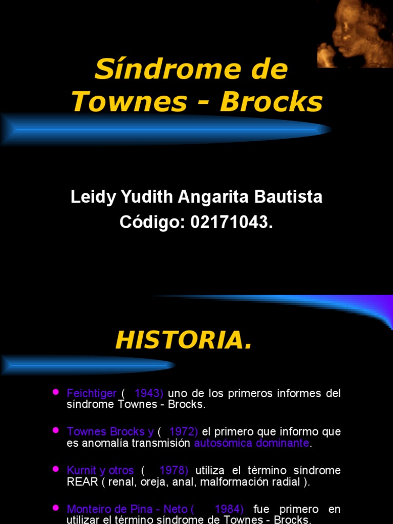 Síndrome Townes Brocks 1 | PDF | Gene | Mutación