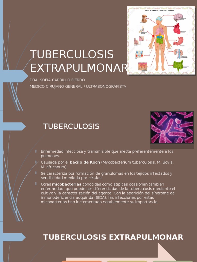 Tuberculosis Extrapulmonar Cenem Junio 2016 | Tuberculosis | Ciencias ...