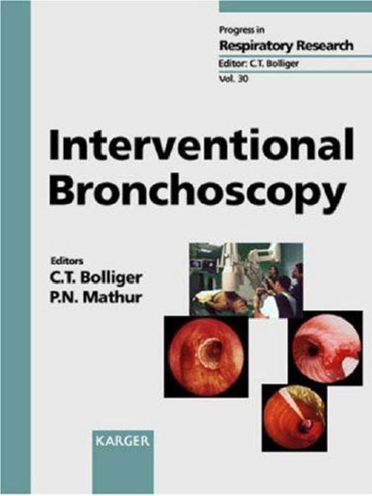 Interventional Bronchos | PDF | Endoscopy | Lung Cancer