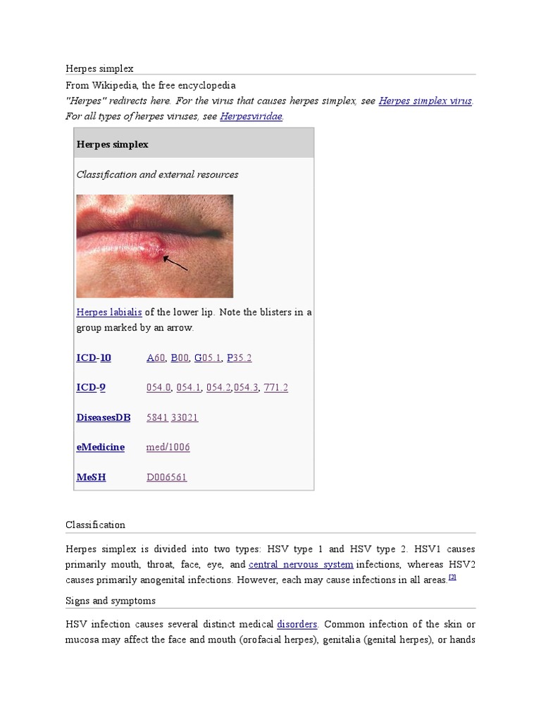 Herpes Simplex | PDF