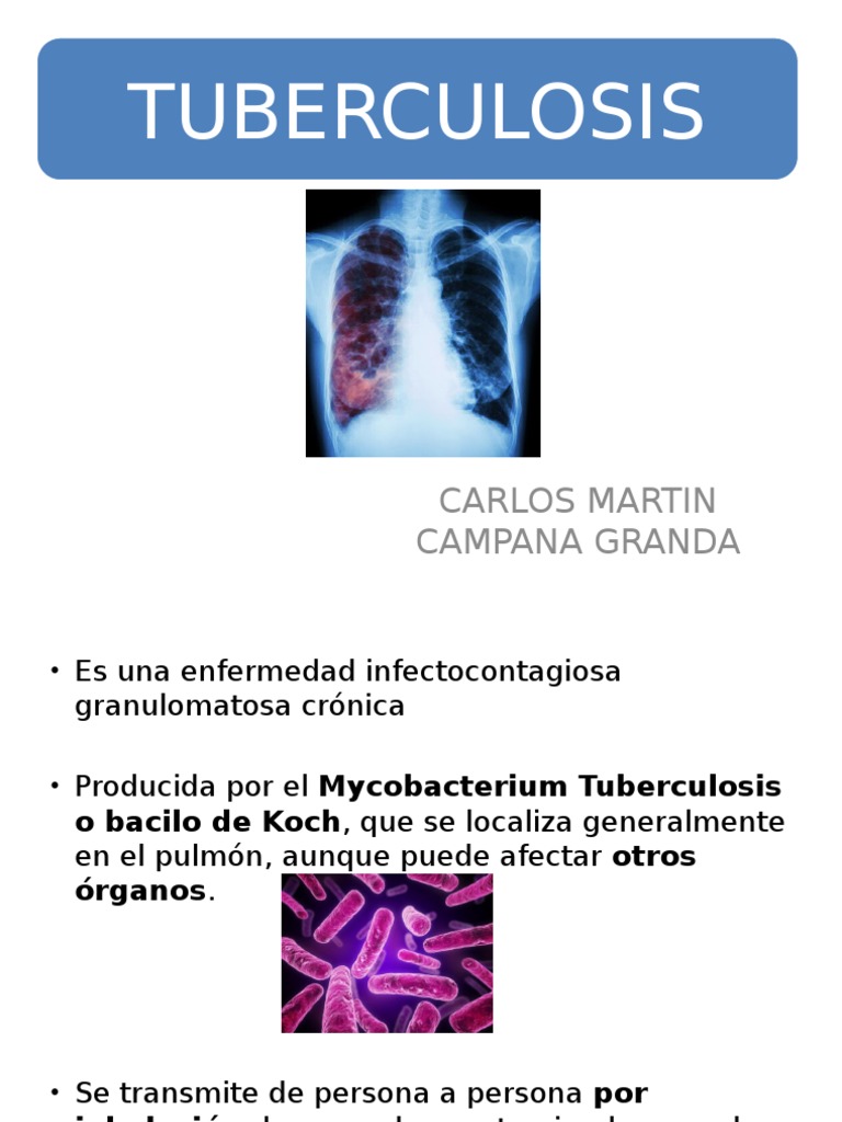 Tuberculosis Imagenes | Tuberculosis | Salud pública