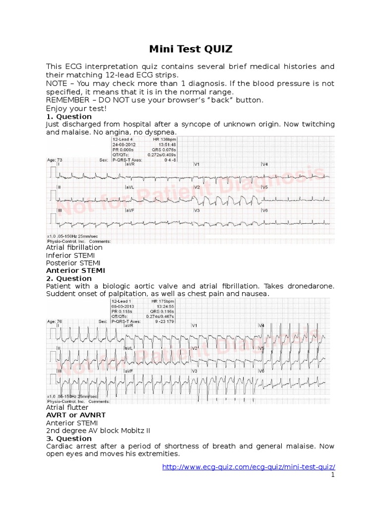 Mini Test QUIZ | PDF | Myocardial Infarction | Electrophysiology