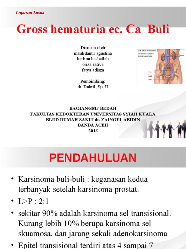 Tumor Buli Buli | PDF