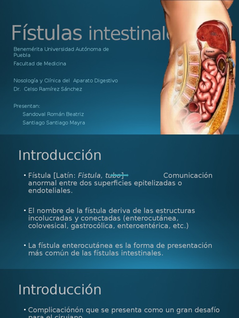 Fístulas intestinales | Enfermedad de Crohn | Diarrea