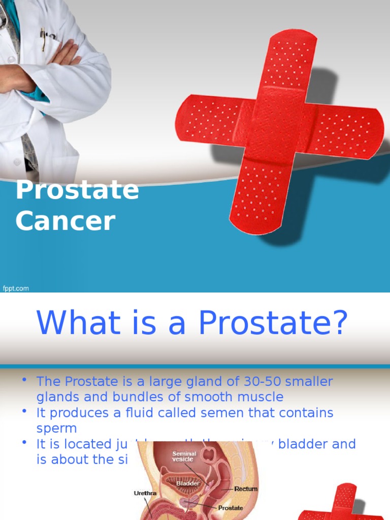 Prostate Cancer | PDF | Prostate Cancer | Prostate Specific Antigen