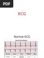 Abnormal ECG Findings in Athletes | PDF | Electrocardiography | Cardiac ...