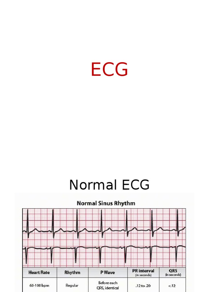 Easy EKG | Download Free PDF | Electrocardiography | Cardiac Arrhythmia