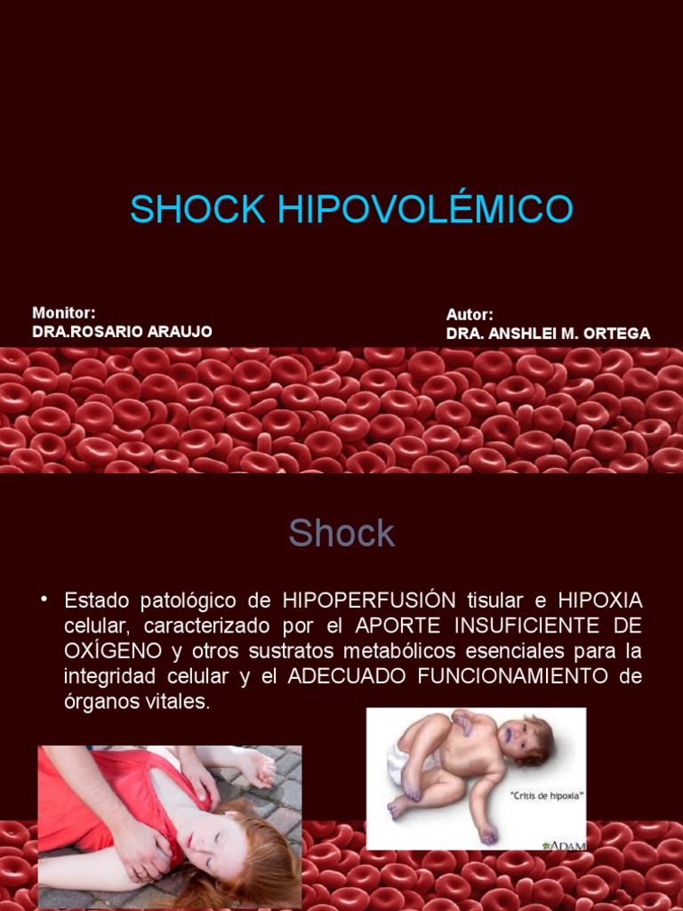 Shock Hipovolémico | PDF | Choque (circulatorio) | Lesión cerebral ...