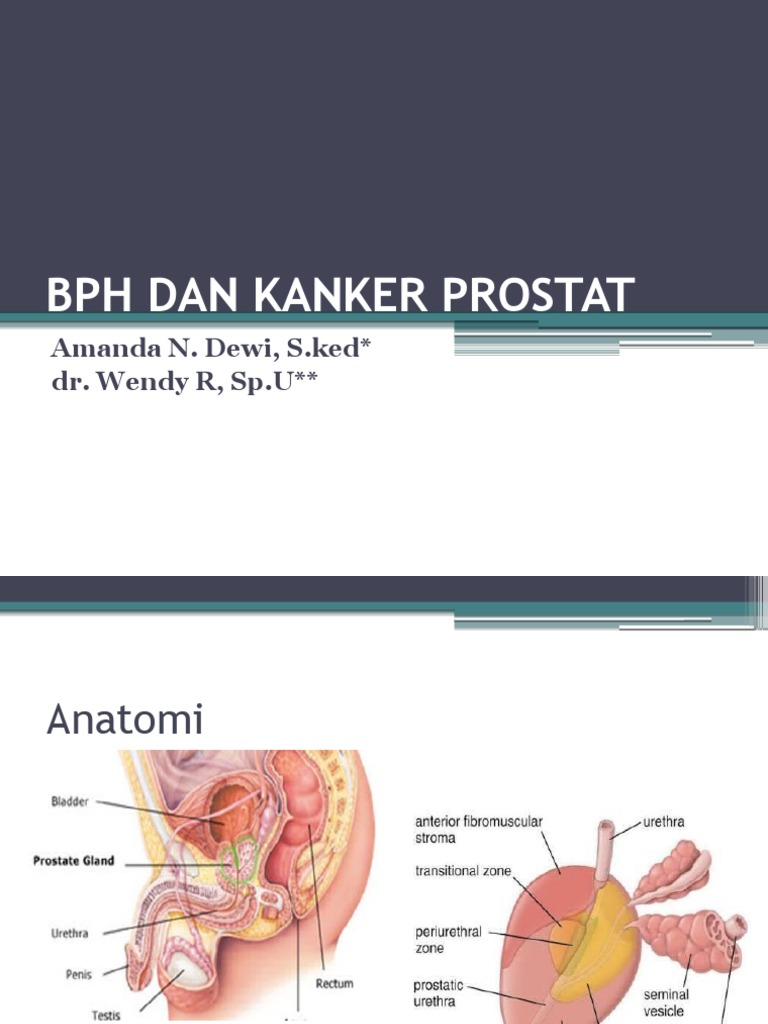 BPH Dan Kanker Prostat | PDF