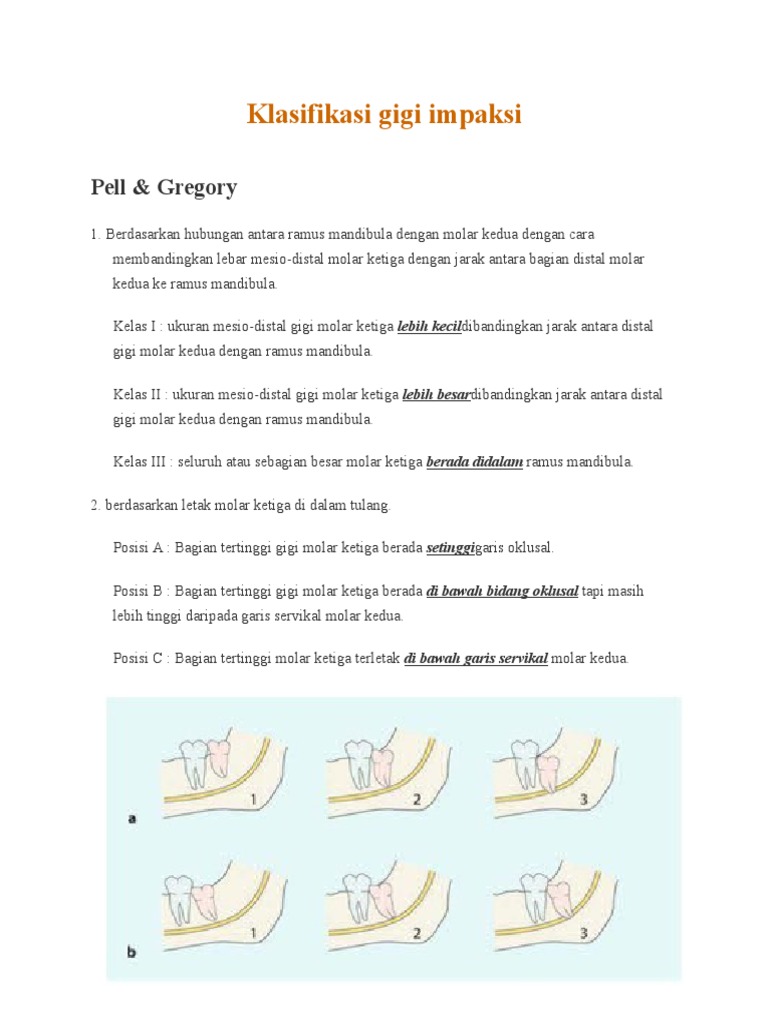 Klasifikasi Gigi Impaksi | PDF