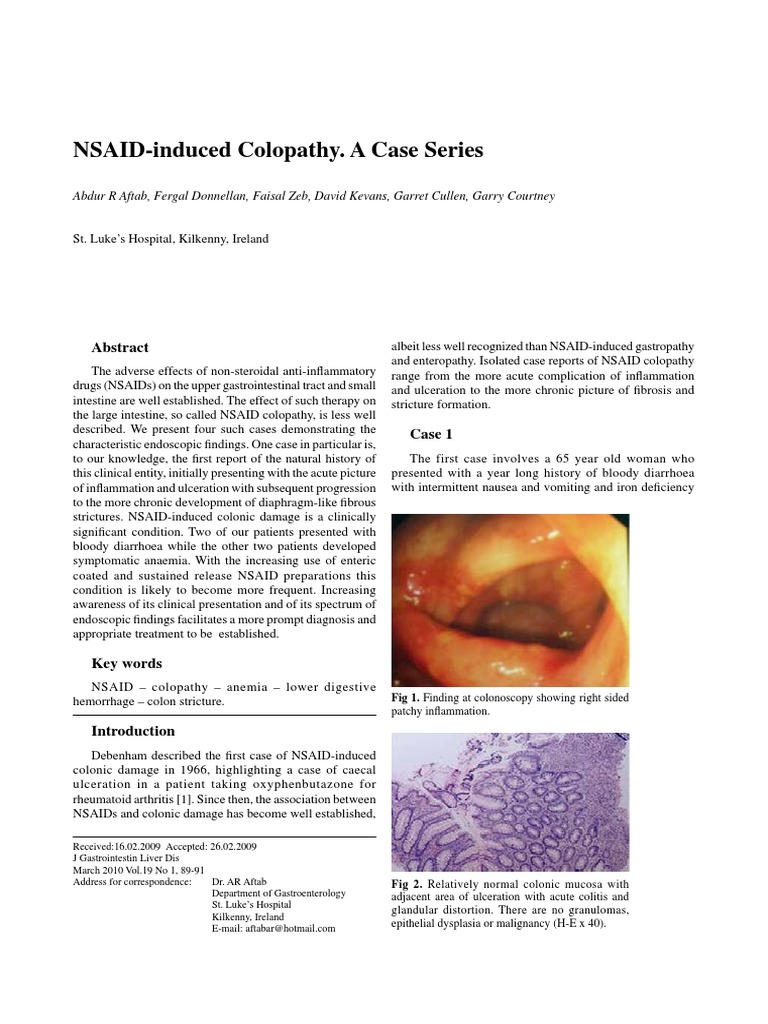 NSAID Colopathy Case Series | PDF | Peptic Ulcer | Colonoscopy