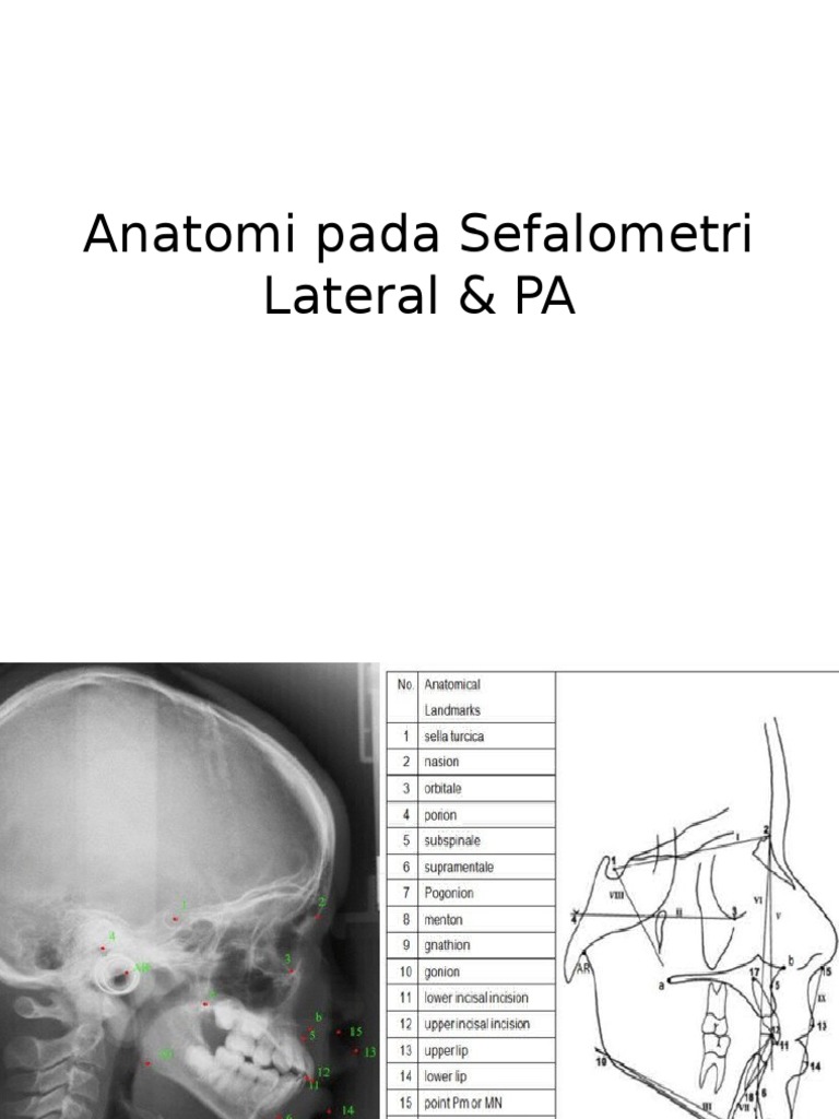 Anatomi Sefalometri | PDF