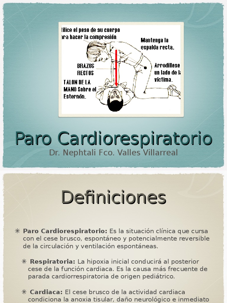 Paro Cardiorespiratorio | Reanimación cardiopulmonar | Paro cardíaco