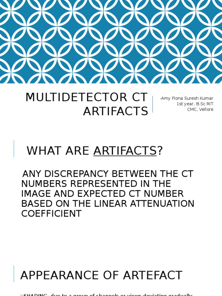 Multidetector CT Artifacts | PDF | Ct Scan | X Ray