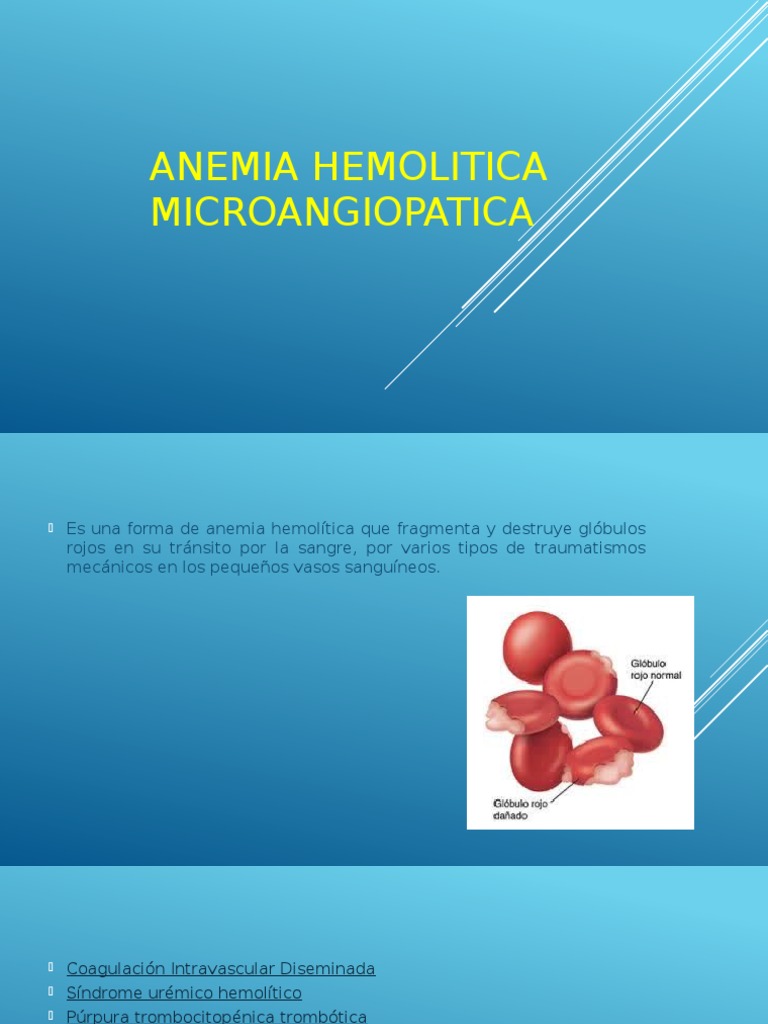 Anemia Hemolitica Microangiopatica | PDF