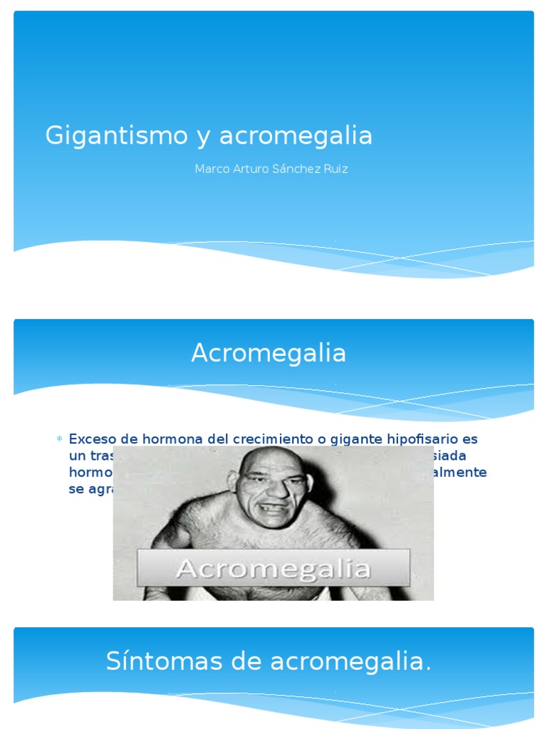 Gigantismo y Acromegalia | Hormona de crecimiento | Órgano (anatomía)