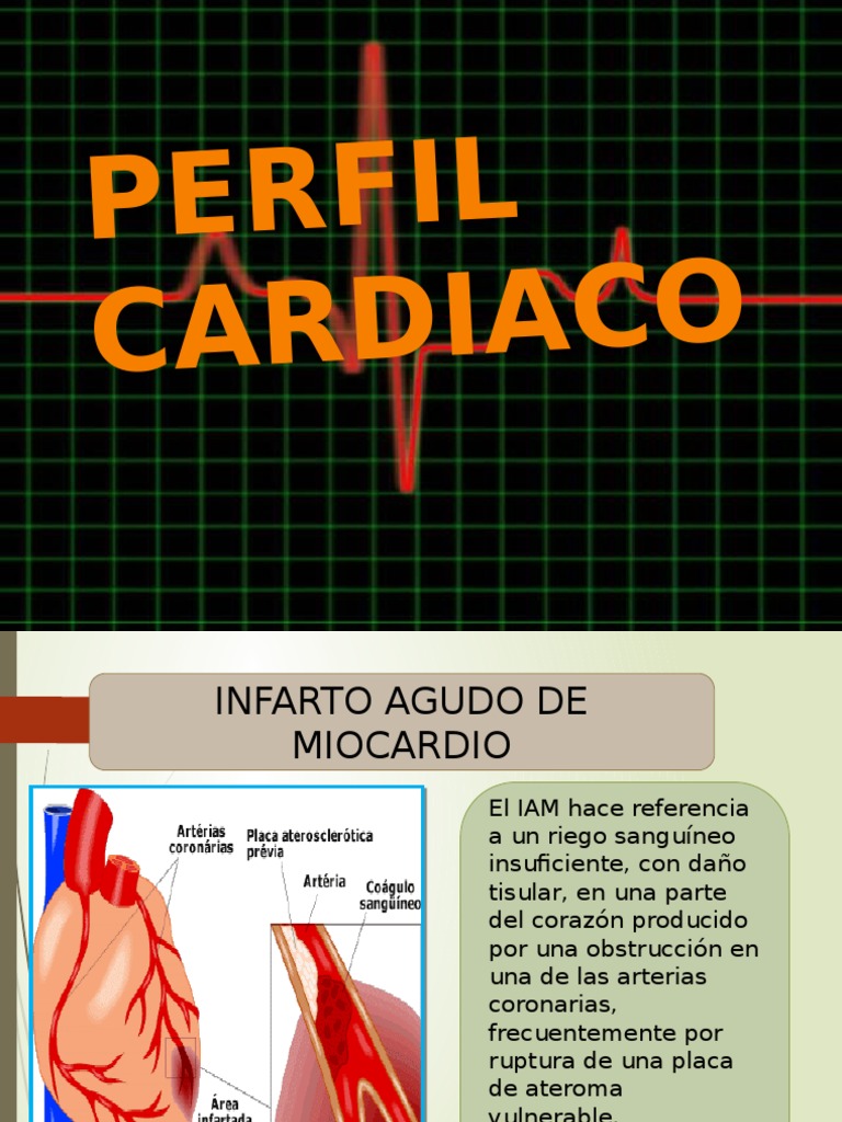 Perfil Cardiaco | PDF | Lactato deshidrogenasa | Transaminasa