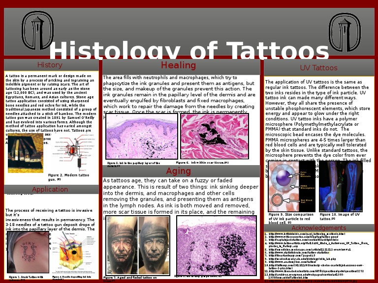 Histology of Tattoos | Tattoo | Ink