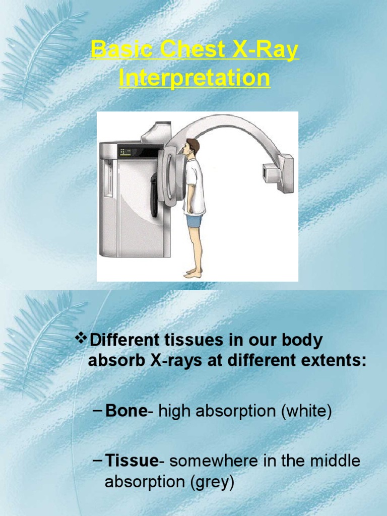 Basic Chest X-Ray Interpretation | PDF | Blood | Artery