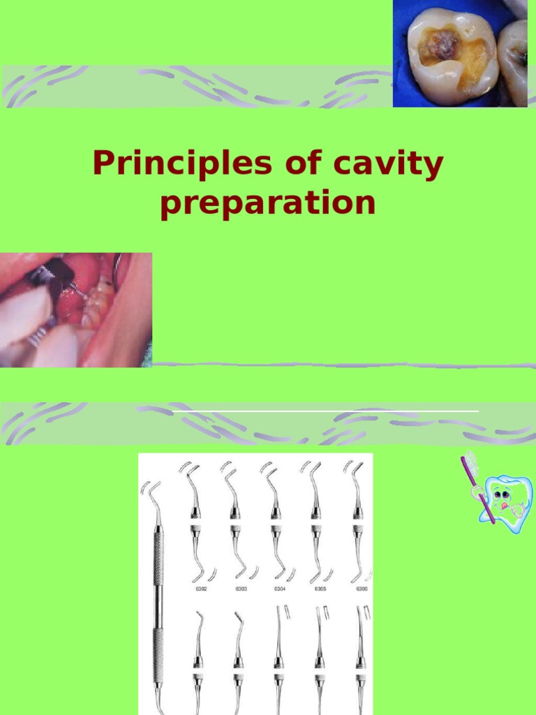 Biological Prinicples of Cavity | PDF | Tooth Enamel | Dentin