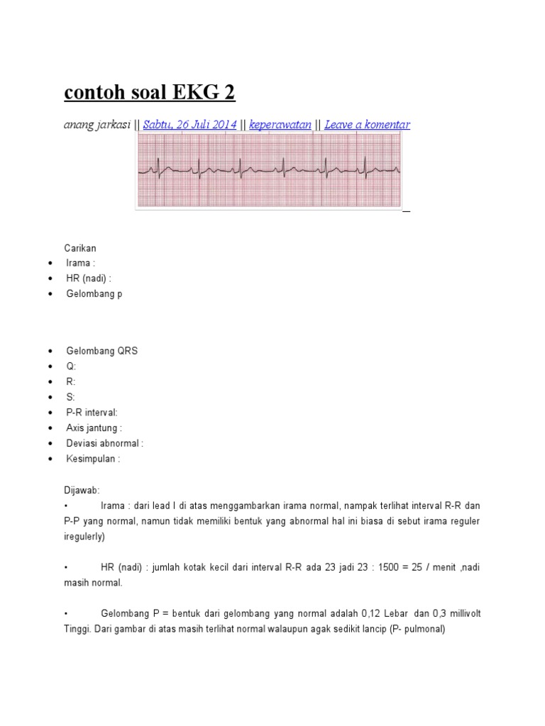 Contoh Soal EKG 2 | PDF