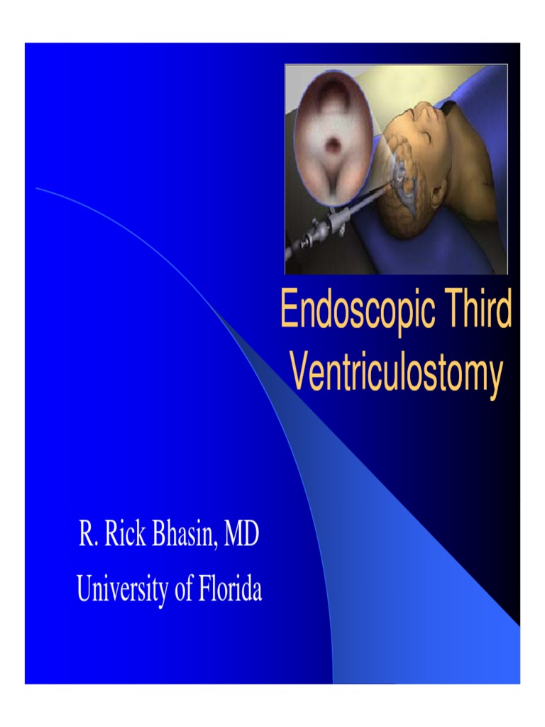 Endoscopic Third Ventriculostomy Overview | PDF | Neurology | Medical ...