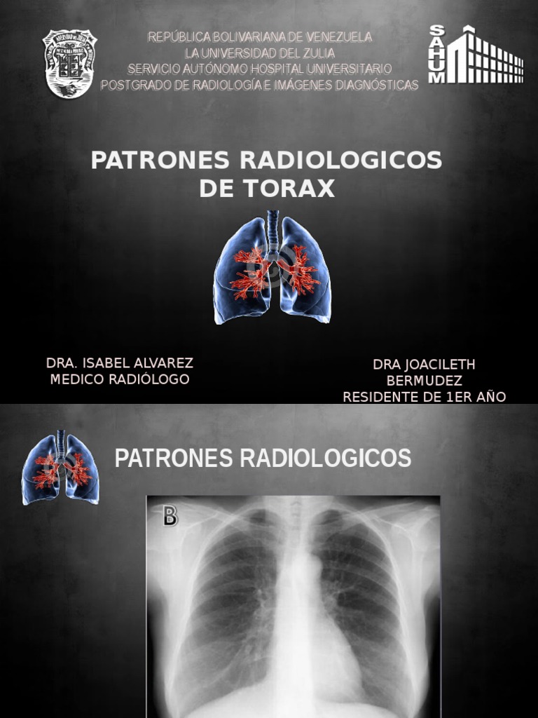 Patrones Radiologicos Torax | Enfermedad pulmonar obstructiva crónica ...