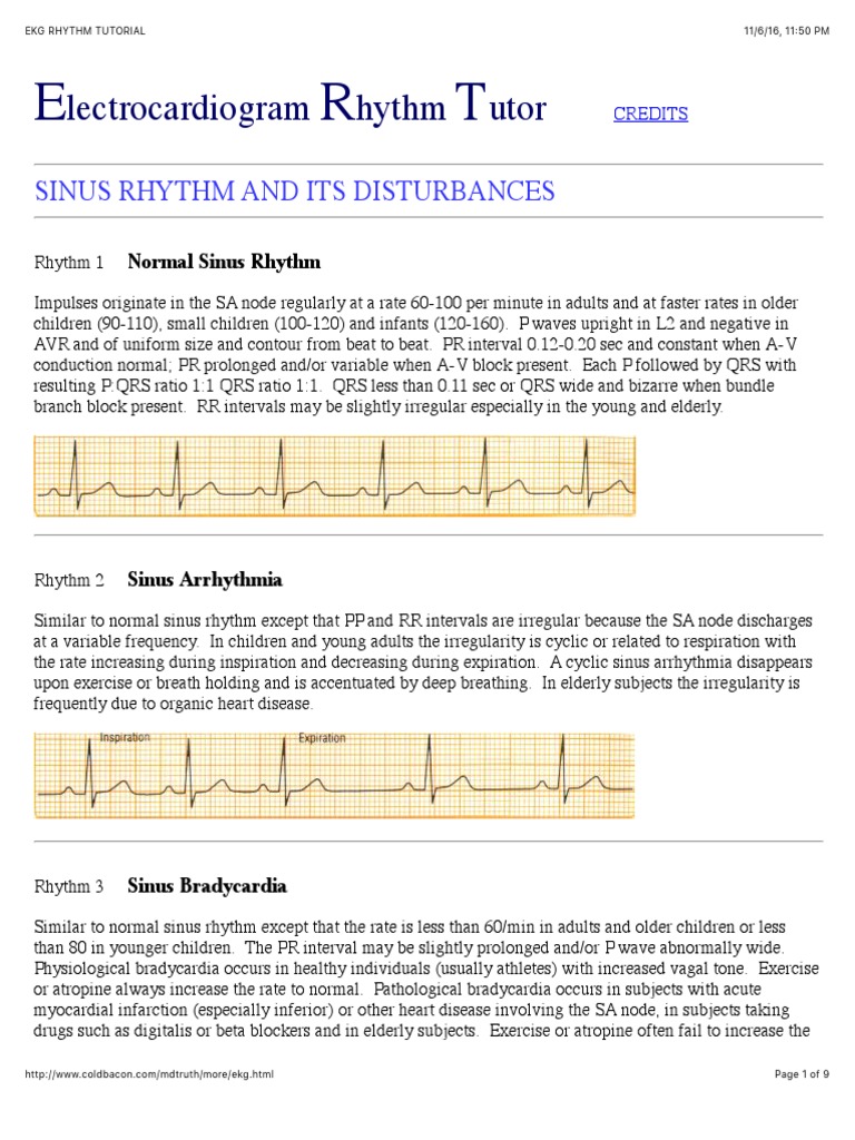 Ekg Rhythm Tutorial | Cardiac Arrhythmia | Cardiac Electrophysiology