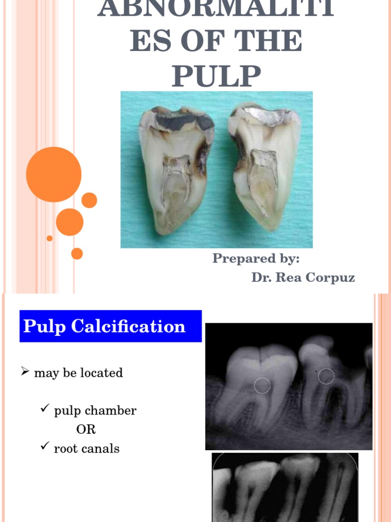 Abnormalities of the Pulp | Human Tooth | Mouth | Free 30-day Trial ...